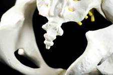 Dolor de Coxis: Causas, Diagnóstico y Tratamiento | InfoEspalda